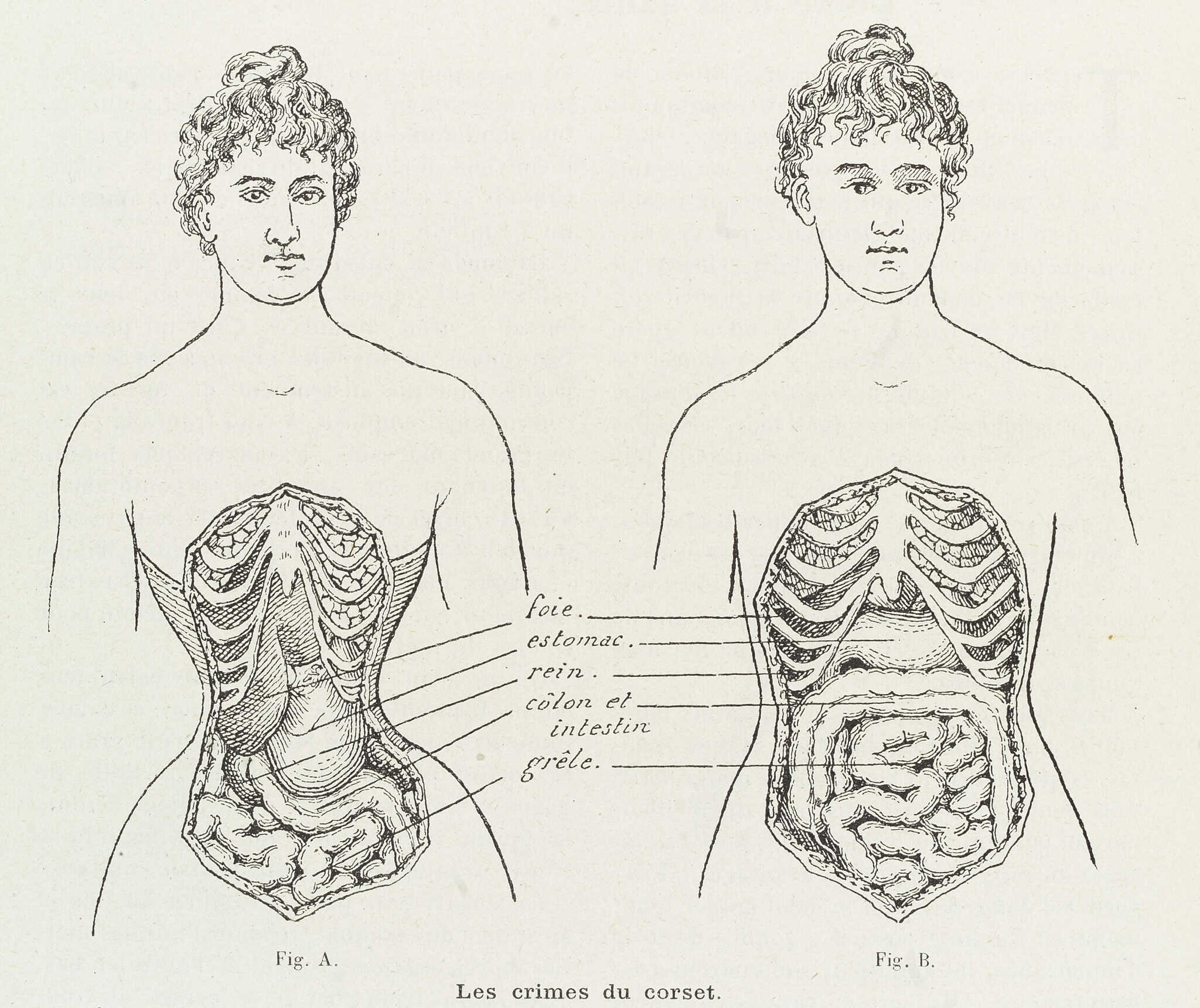 CORSET & POWER: FROM OPPRESSION TO EXPRESSION - IRK Magazine